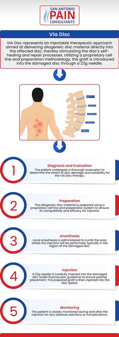 Cost of Via Disc Procedure Near Me in San Antonio, TX