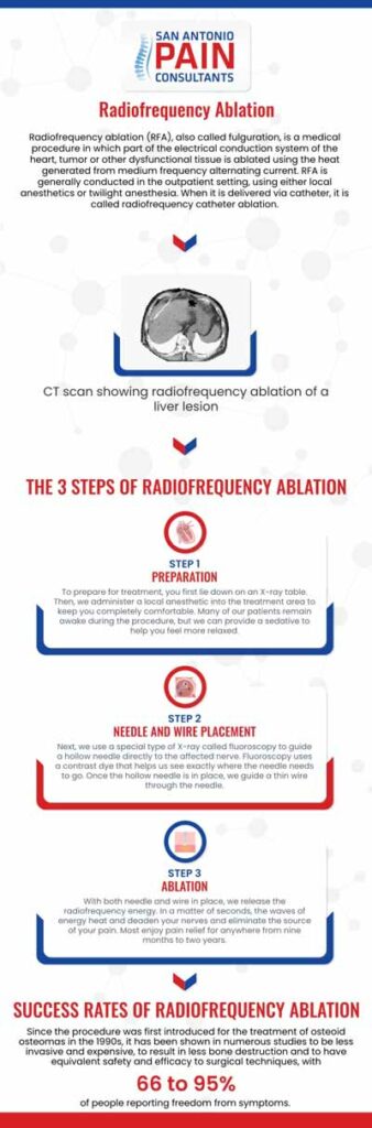 Cervical Radiofrequency Ablation Near Me in San Antonio, TX