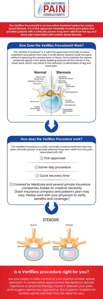 Everything You Need to Know About the Vertiflex Procedure