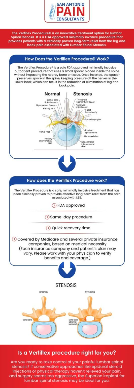 Everything You Need to Know About the Vertiflex Procedure