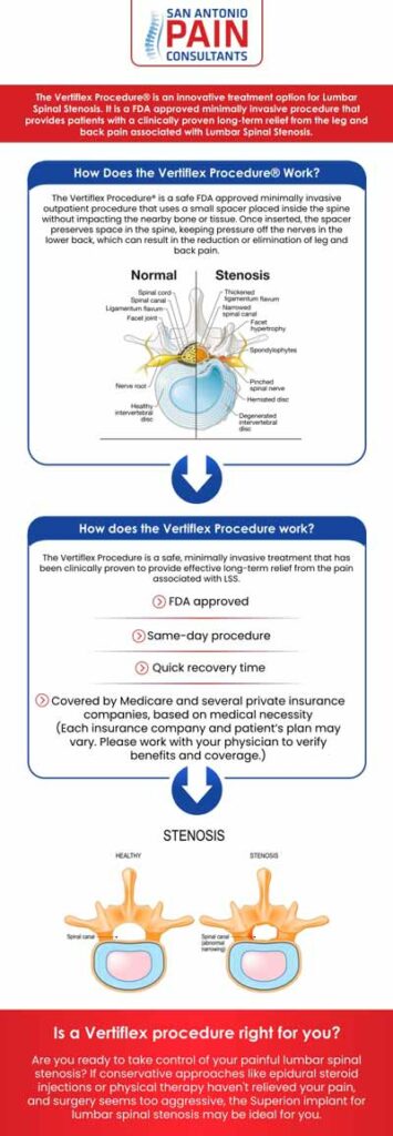 Everything You Need to Know About the Vertiflex Procedure