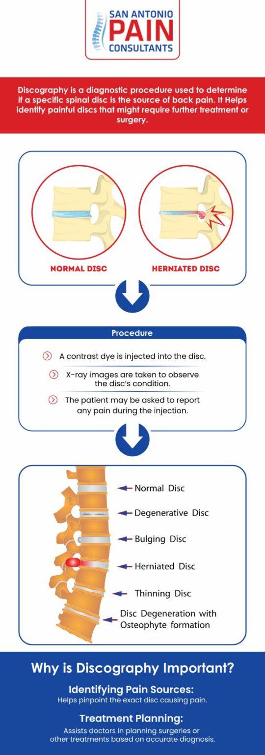 Discogram (Discography) Specialist Near Me in San Antonio, TX