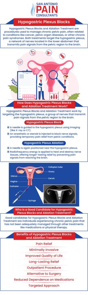 Hypogastric Plexus Blocks and Ablation Treatment in San Antonio, TX